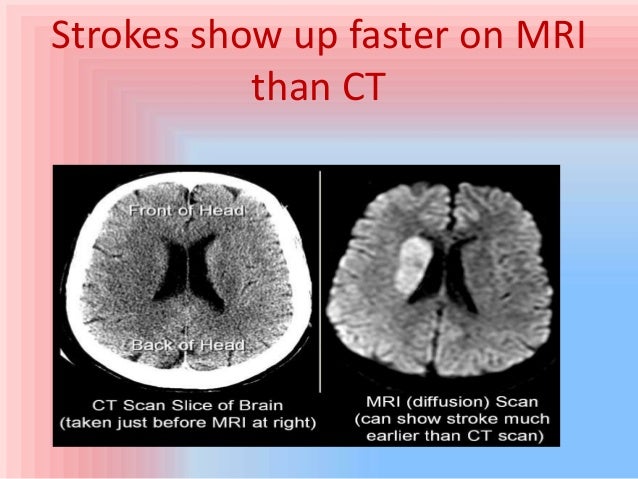 Brain Ct And Mri In Icu