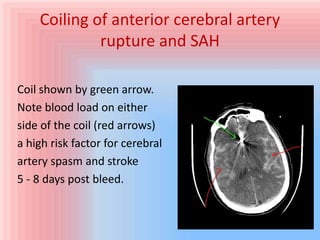 Brain ct and mri in icu | PPTX