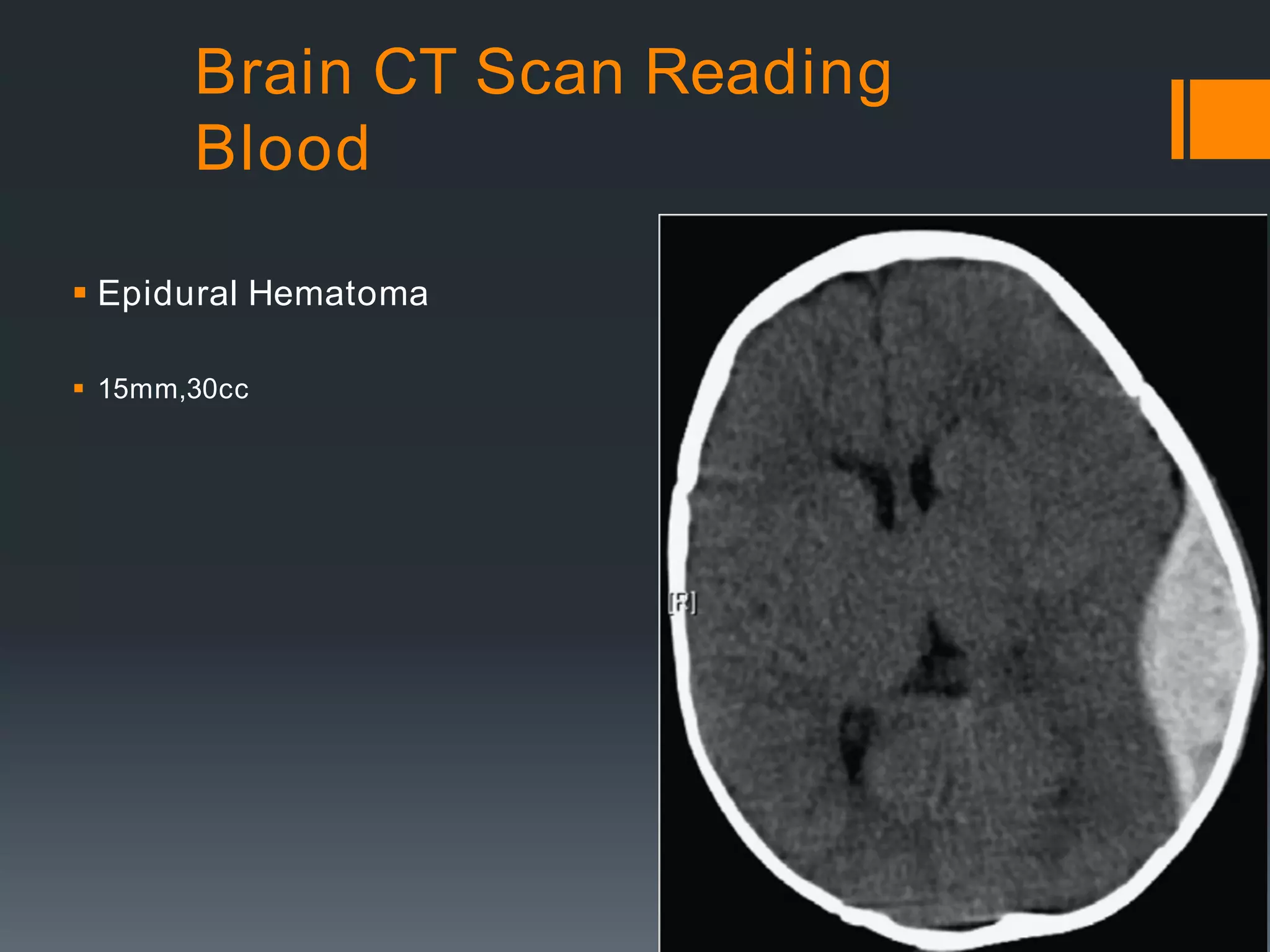 Brain ct interpretation.pdf