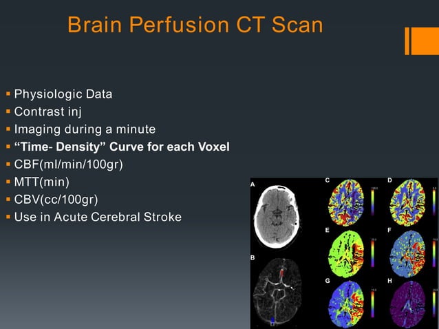 Brain ct interpretation.pdf | Brain and Nervous System Disorders ...