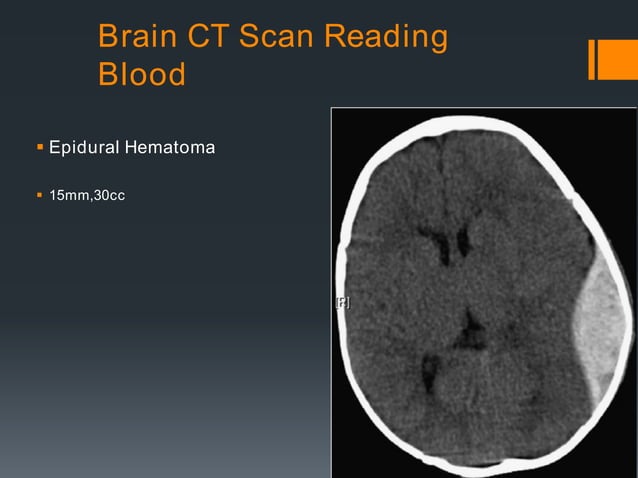 Brain ct interpretation.pdf | Brain and Nervous System Disorders ...