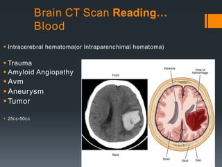 Brain ct interpretation.pdf