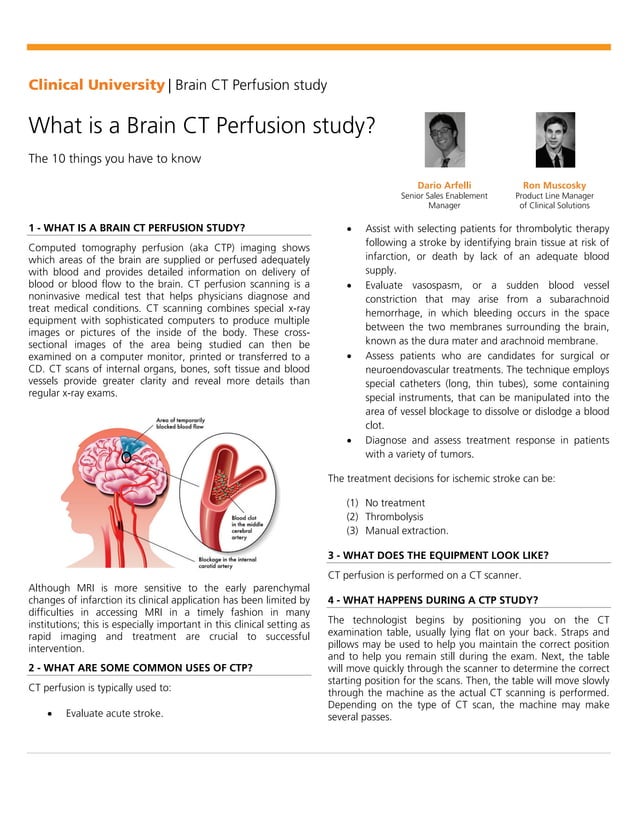What is a Brain CT Imaging Perfusion Study? | PDF
