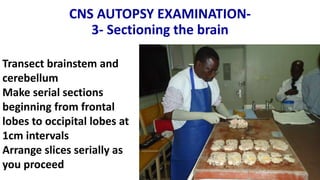 Brain cut up for the general pathologist | PPT