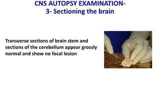 Brain cut up for the general pathologist | PPT