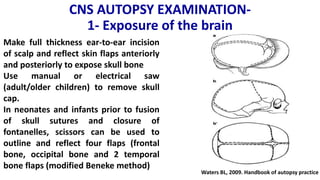 Brain cut up for the general pathologist | PPT | Death, Injury, or ...