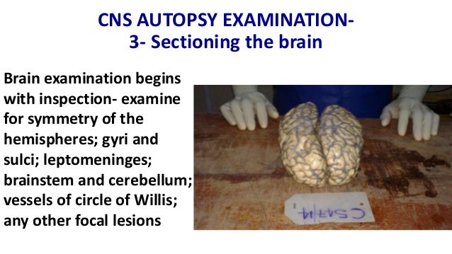 Brain cut up for the general pathologist