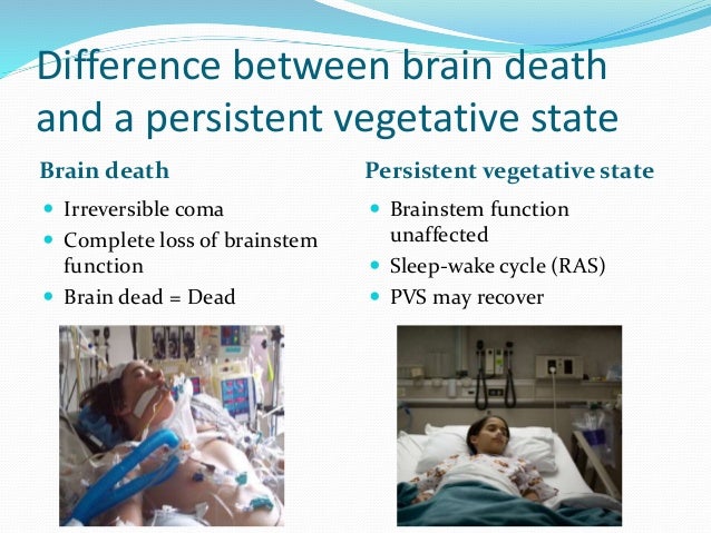 Brain death