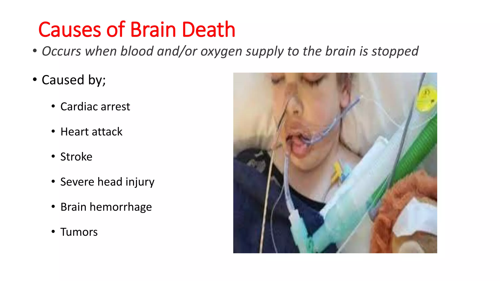 BRAIN DEATH | PPTX