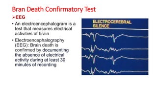 BRAIN DEATH | PPT
