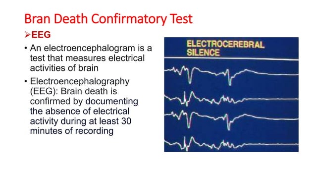 BRAIN DEATH | PPT