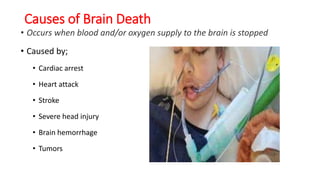 BRAIN DEATH | PPT
