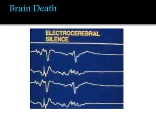 Brain death in paediatrics | PPT
