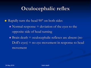 Brain death presentation | PPTX