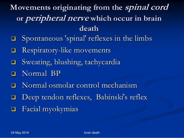 Brain death presentation