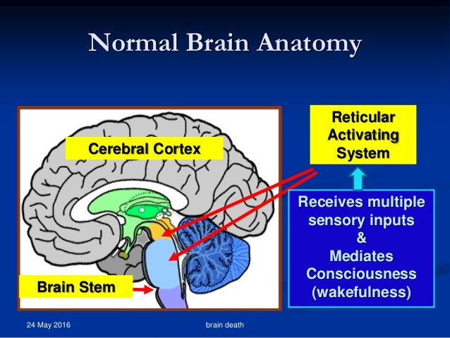Brain death presentation