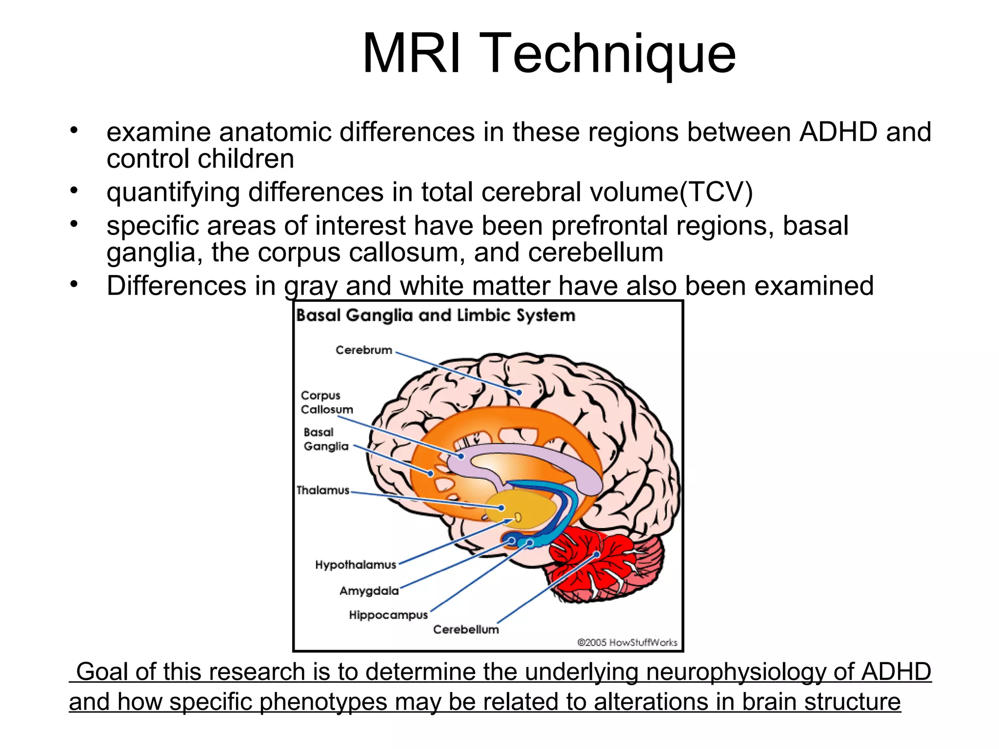 Brain developm adhd2 | PPT
