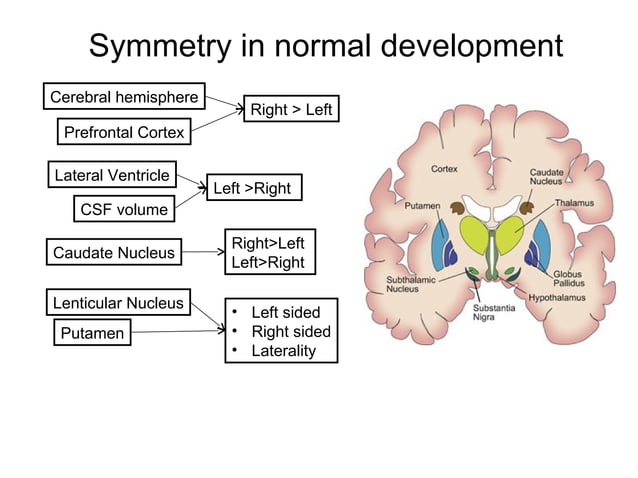 Brain developm adhd2 | PPT | Brain and Nervous System Disorders ...