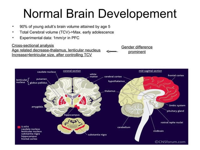 Brain developm adhd2 | PPT | Brain and Nervous System Disorders ...