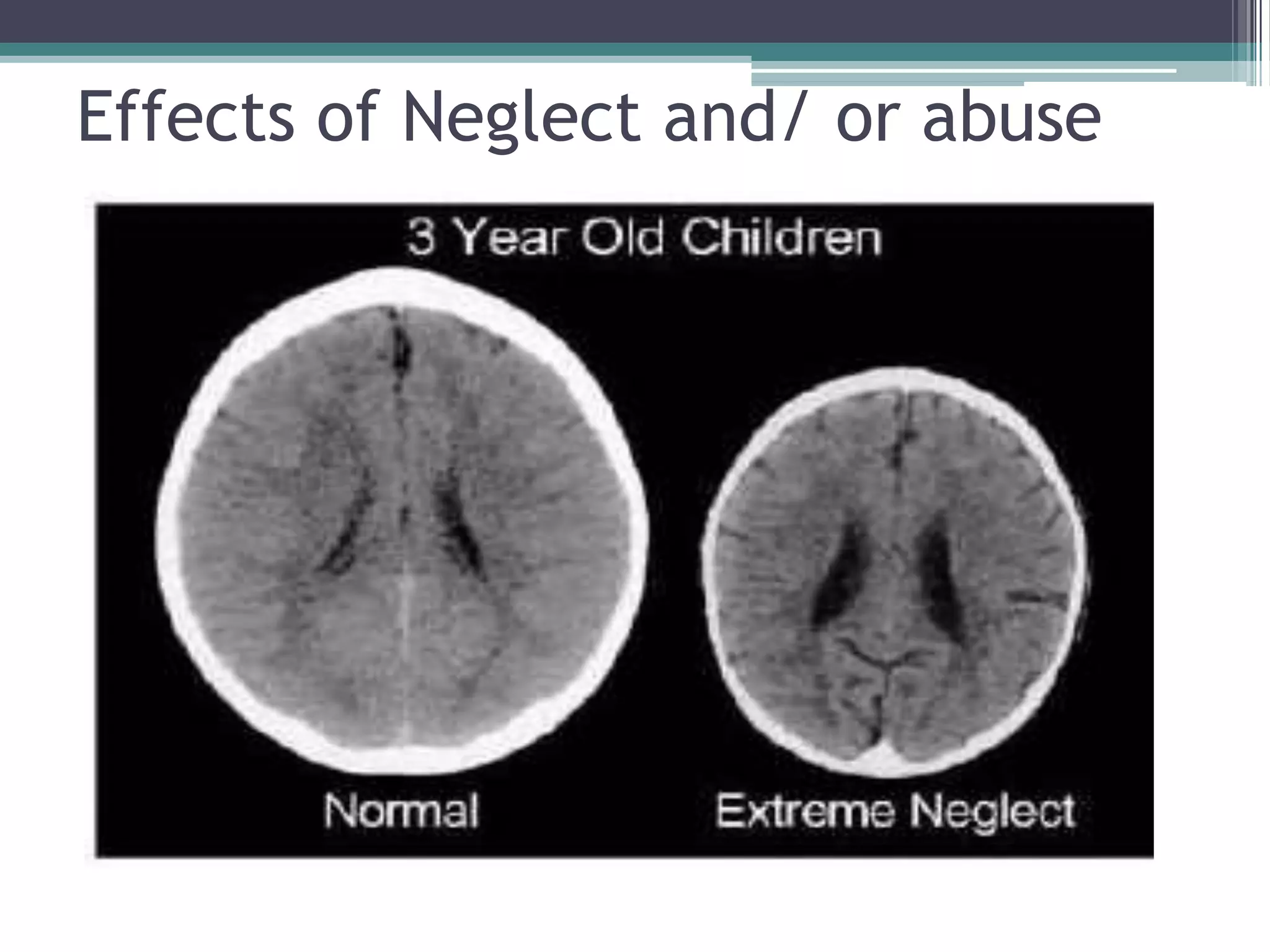 Brain Development.pptx | Brain and Nervous System Disorders | Diseases ...