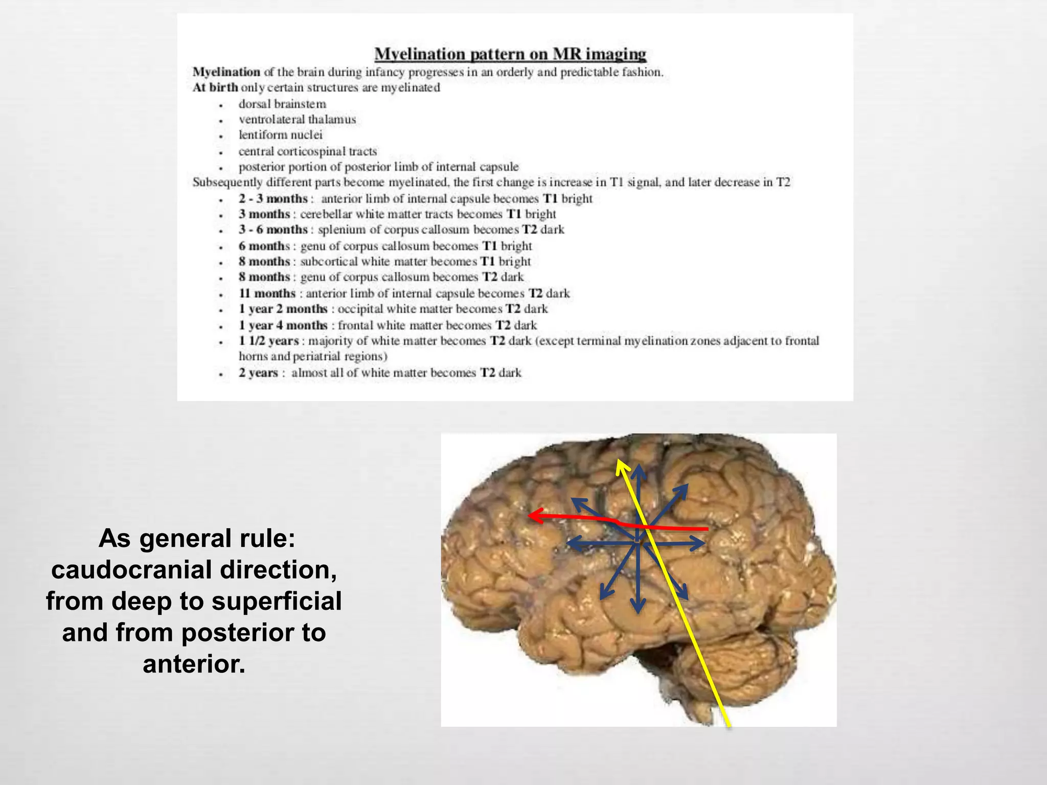 Brain development on MRI: an introduction | PPTX