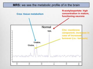 Brain development on MRI: an introduction | PPTX