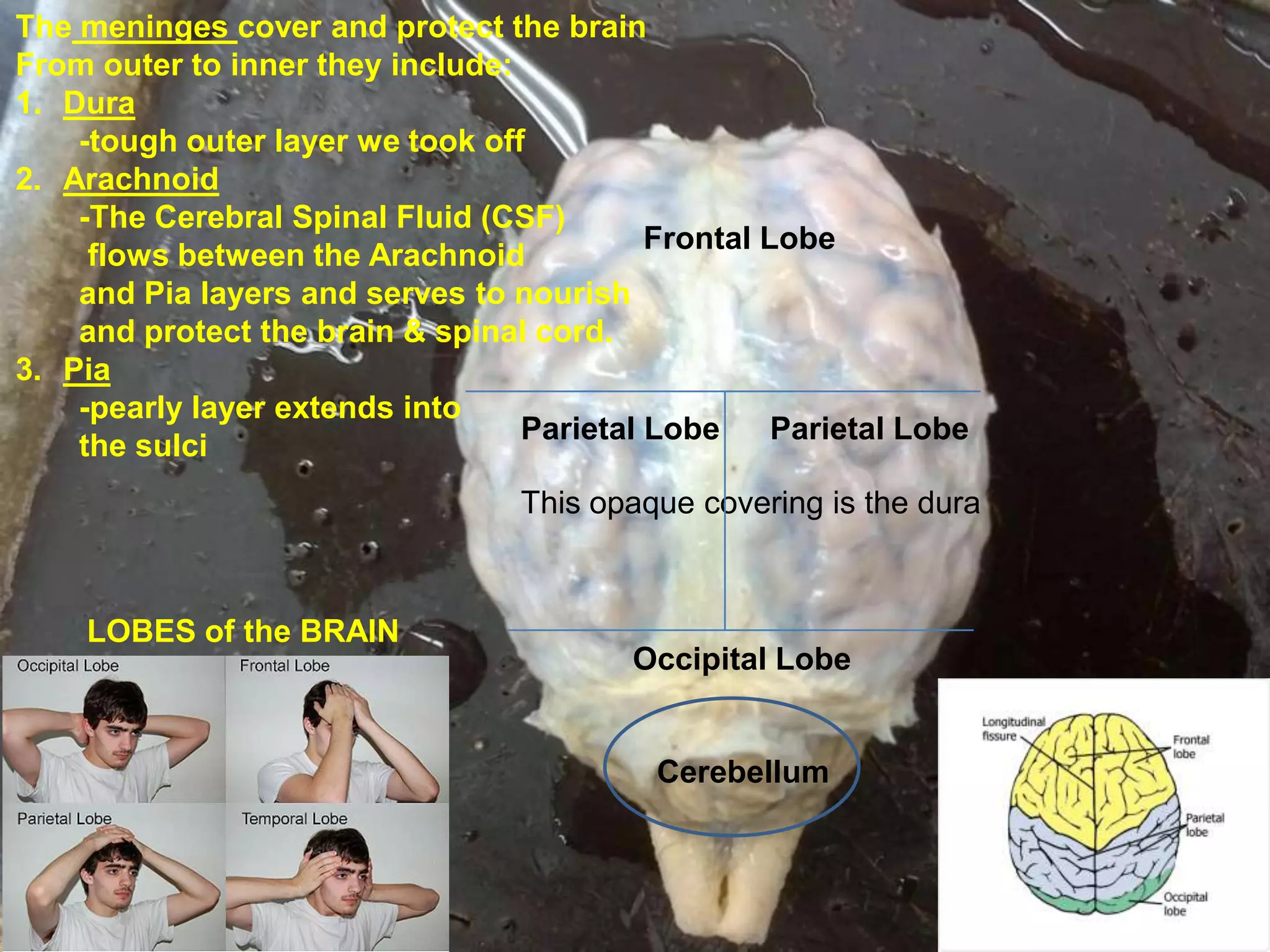 Brain dissection pictures | PPTX