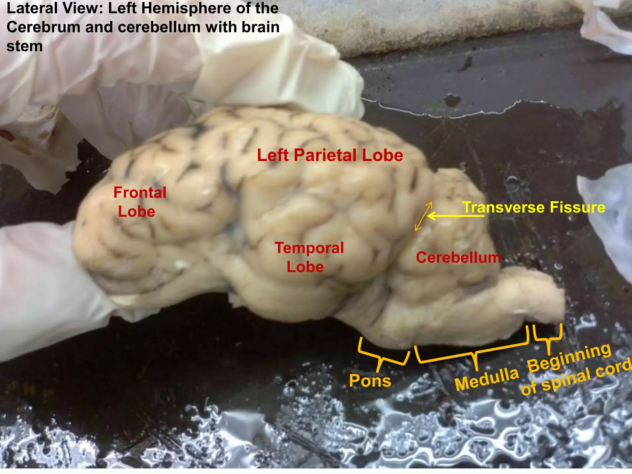 Brain dissection pictures | PPTX