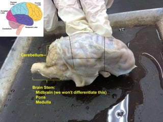 Brain dissection pictures | PPTX