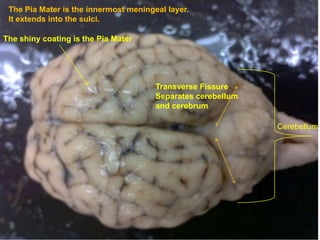 Brain dissection pictures | PPTX