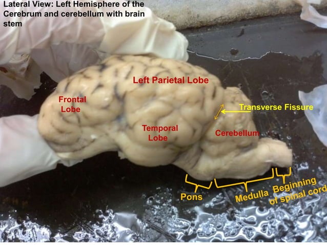 Brain dissection pictures | PPTX
