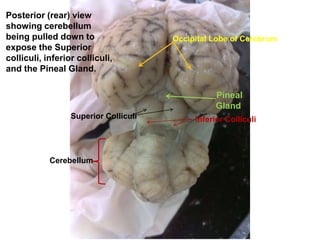 Brain dissection pictures | PPTX