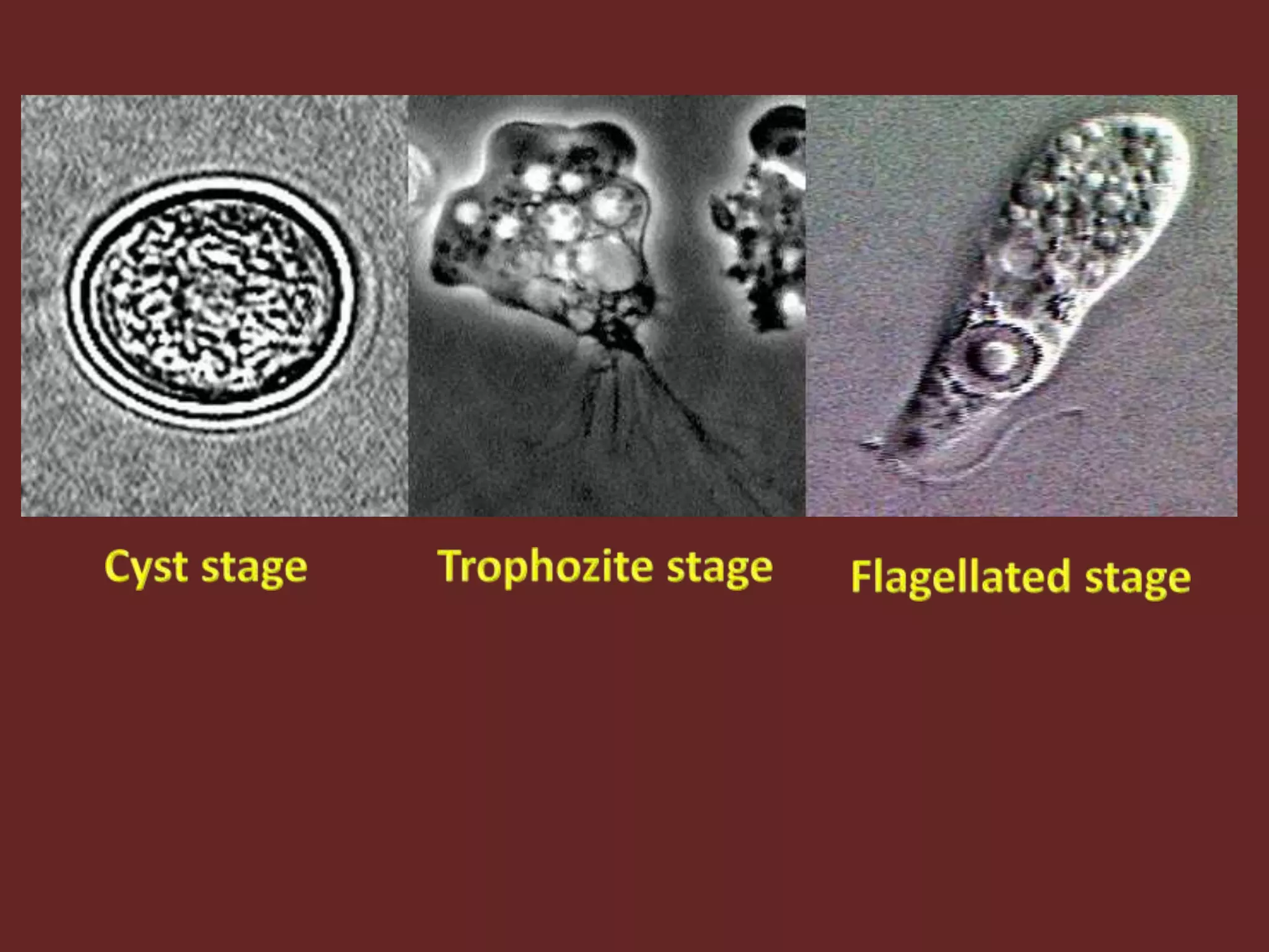 Brain eating amoeba | PPTX