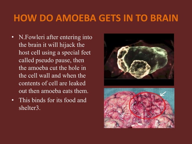 Brain eating amoeba | PPTX | Infectious Diseases | Diseases and Conditions