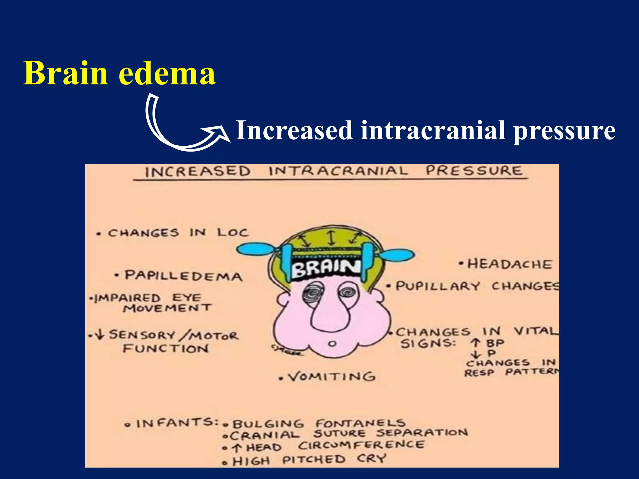 Brain edema | PPSX