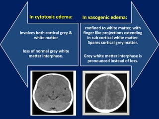 Cerebral Edema, Interstitial : Edema cerebral: o que é, sintomas ...