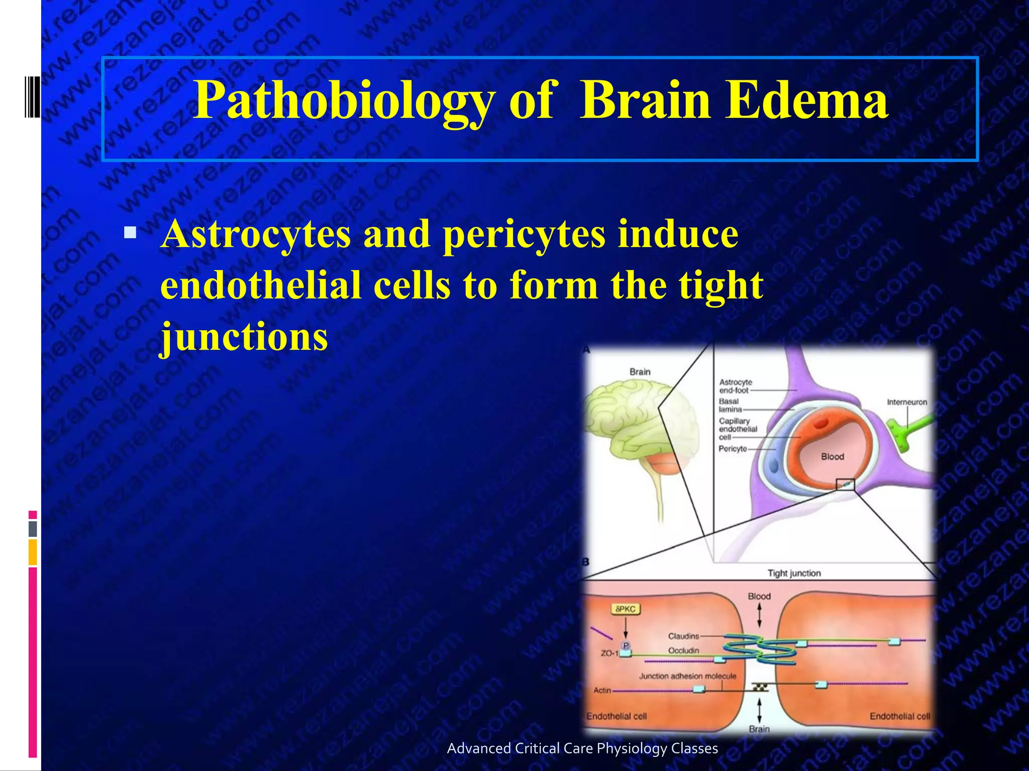 Brain edema23 | PDF
