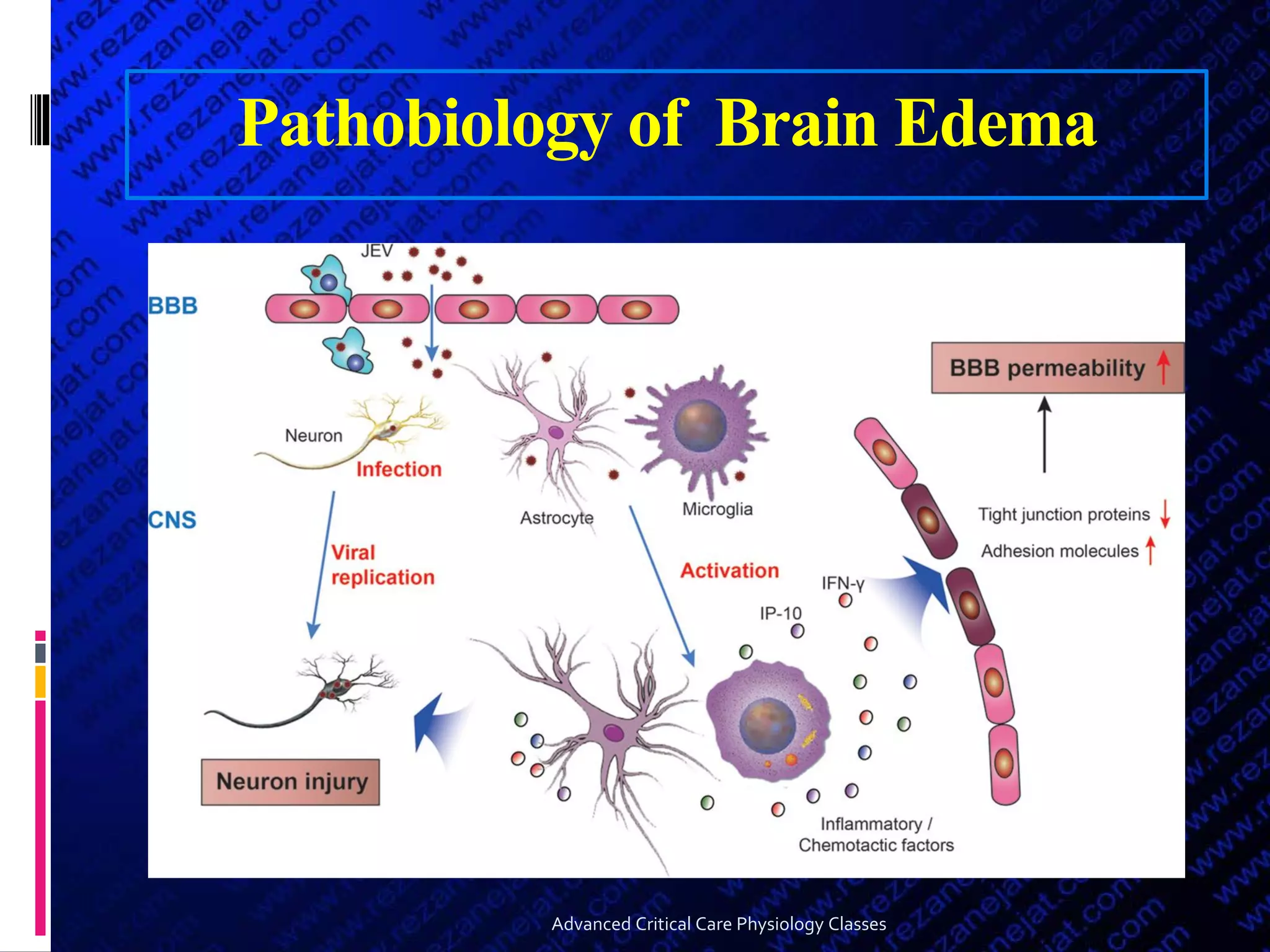 Brain edema23 | PDF