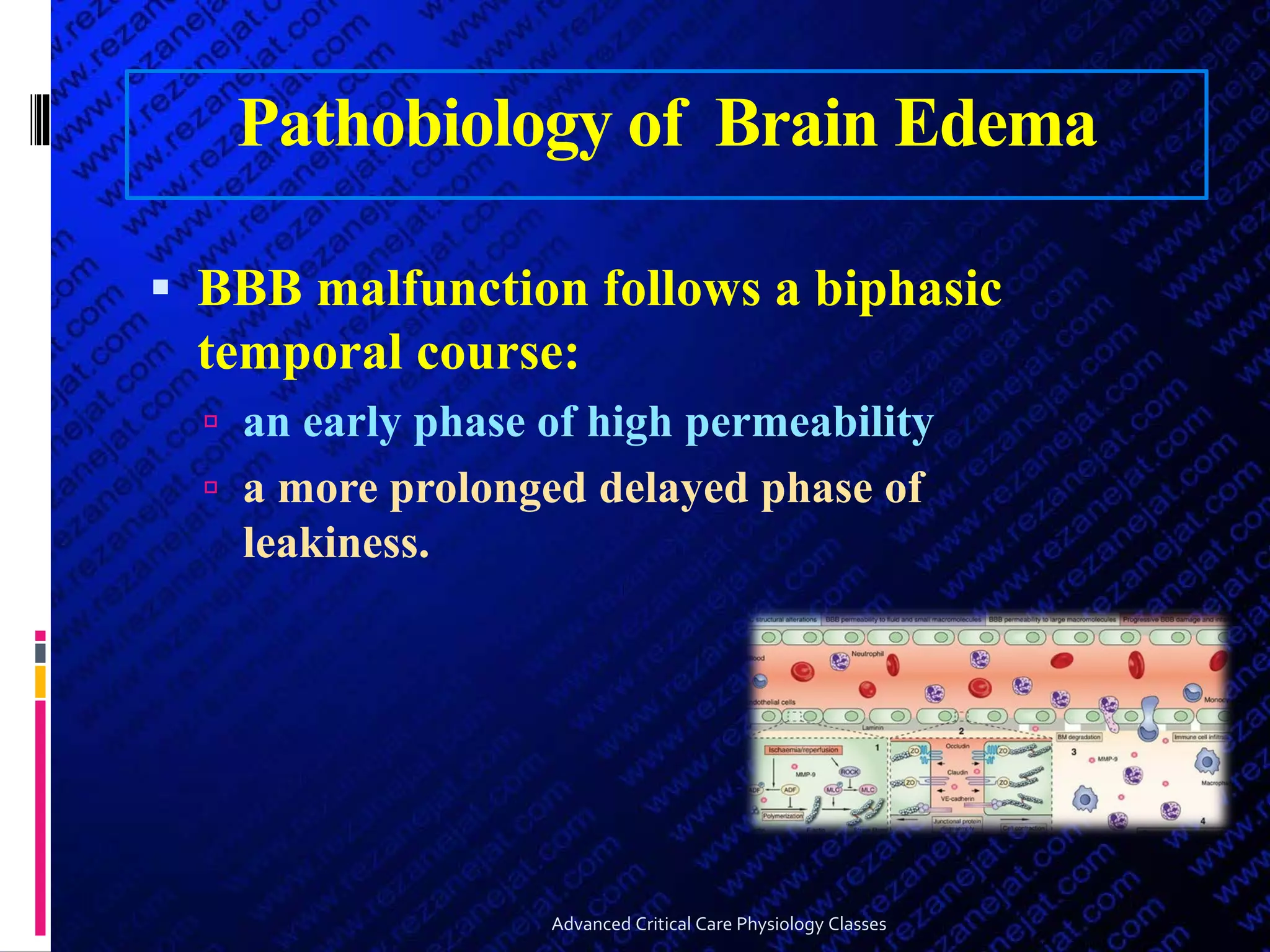 Brain edema23 | PDF