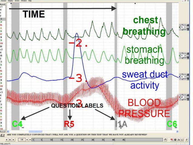 Brain electrical oscillation signature profiling(beos) | PPTX