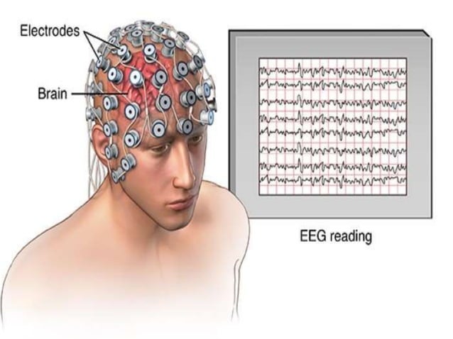 Brain electrical oscillation signature profiling(beos) | PPTX