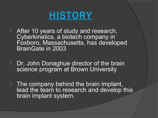 Brain gate | PPT