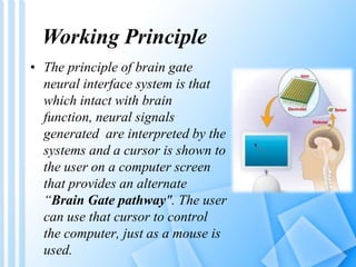 Brain Gate System | PPT