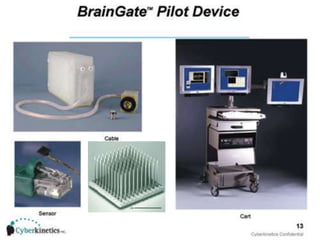 Brain Gate System | PPT