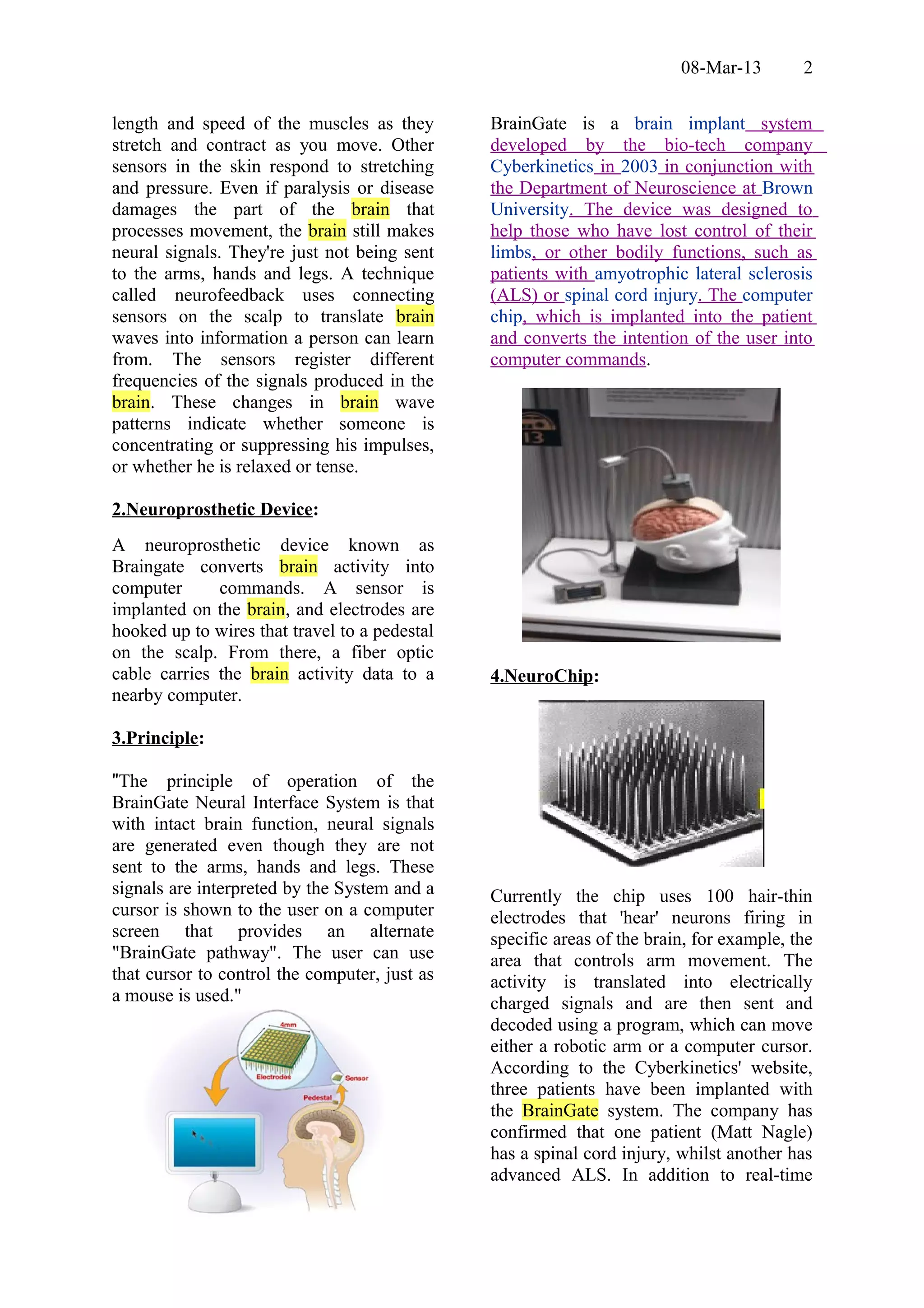 Braingate | DOC | Brain and Nervous System Disorders | Diseases and ...