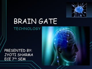 Brain gate | PPT