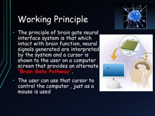 Brain gate | PPT