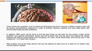 Brain gate technology | PPT