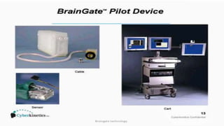 Brain gate technology | PPT