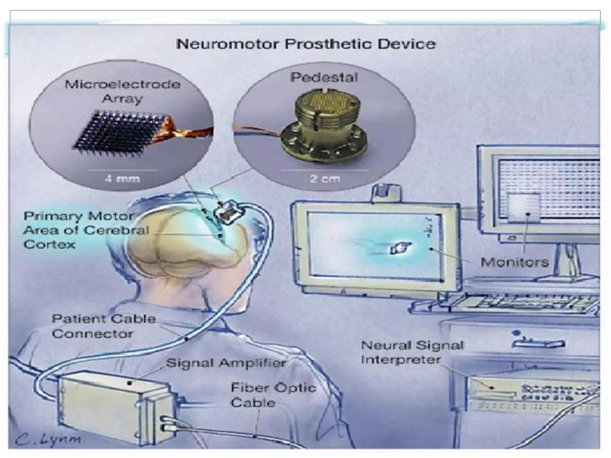 Brain gate by SrujanaRondla ..pptx